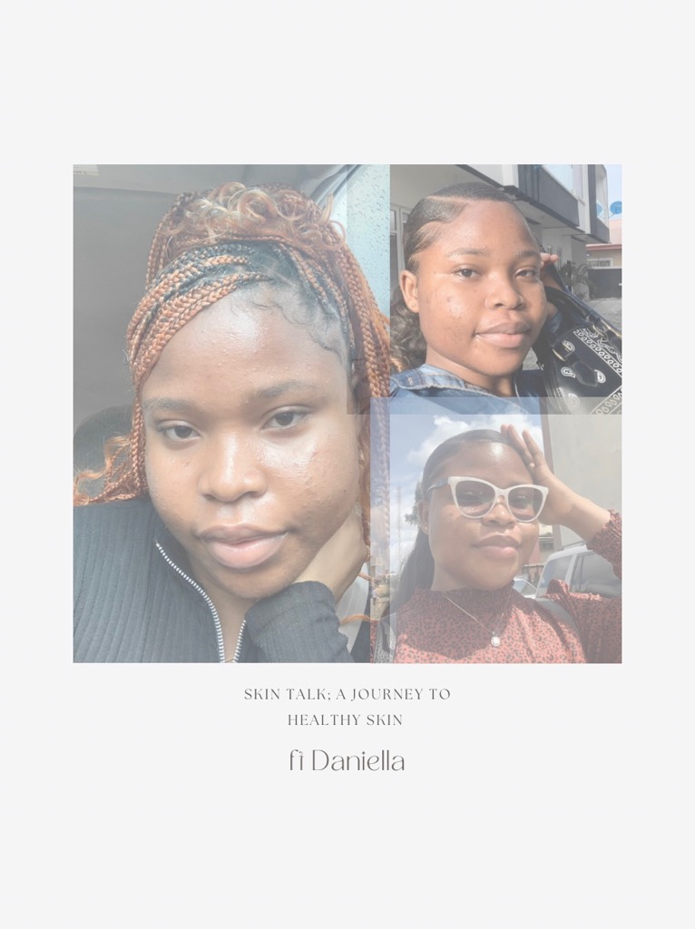 Skin Talk: Journey To Healthy Skin/Skincare Ft Daniella – AD